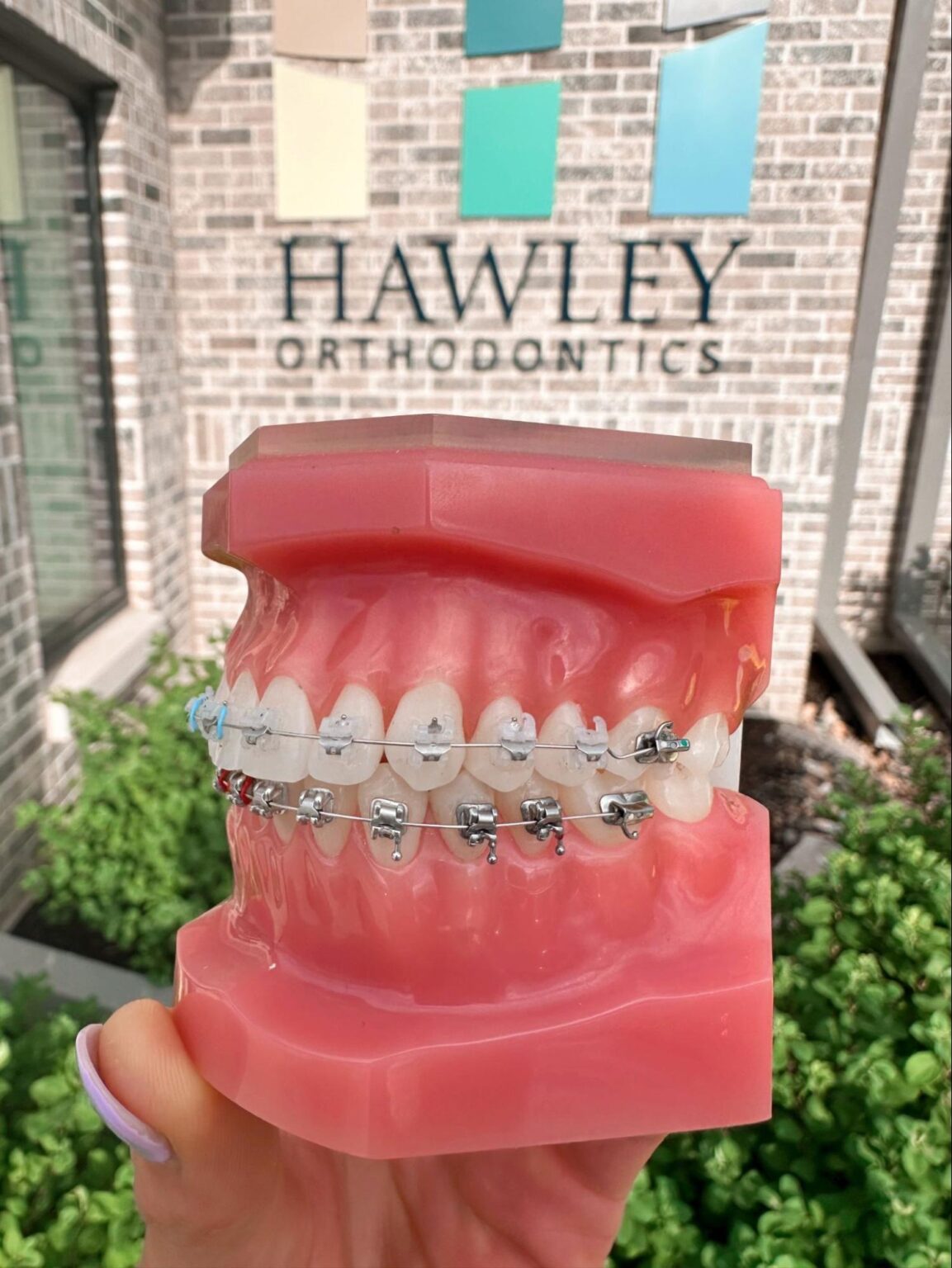 Invisalign vs. Clear Braces: Which One Is Right For You - Hawley ...